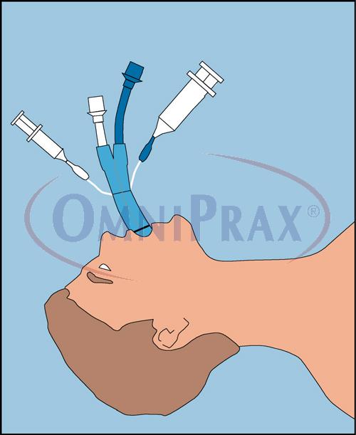 OmniPrax - KOMBI TUBUS